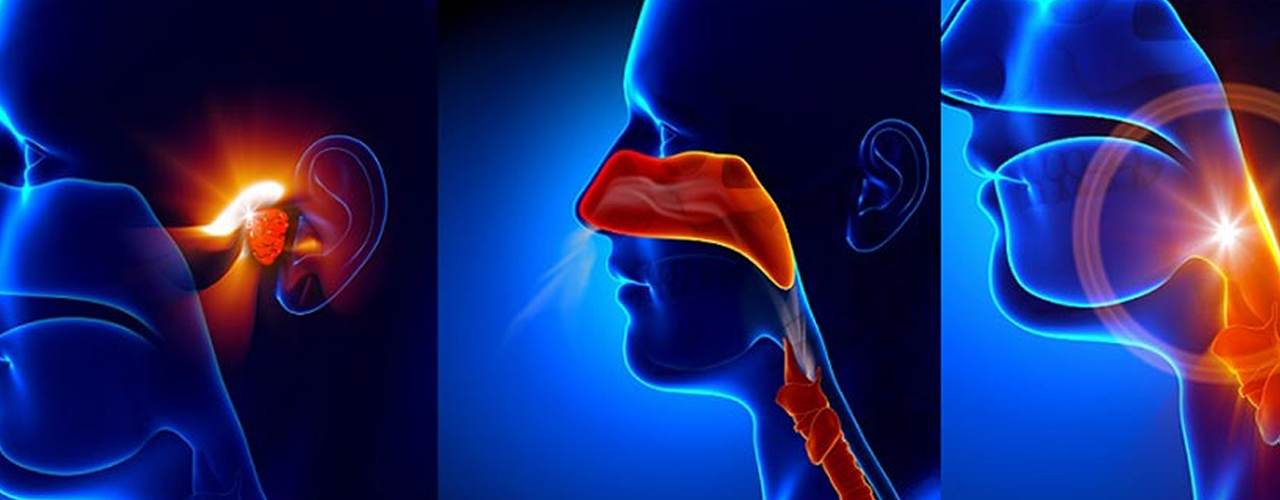 Department of Otorhinolaryngology - Shri Rawatpura Sarkar Institute of ...